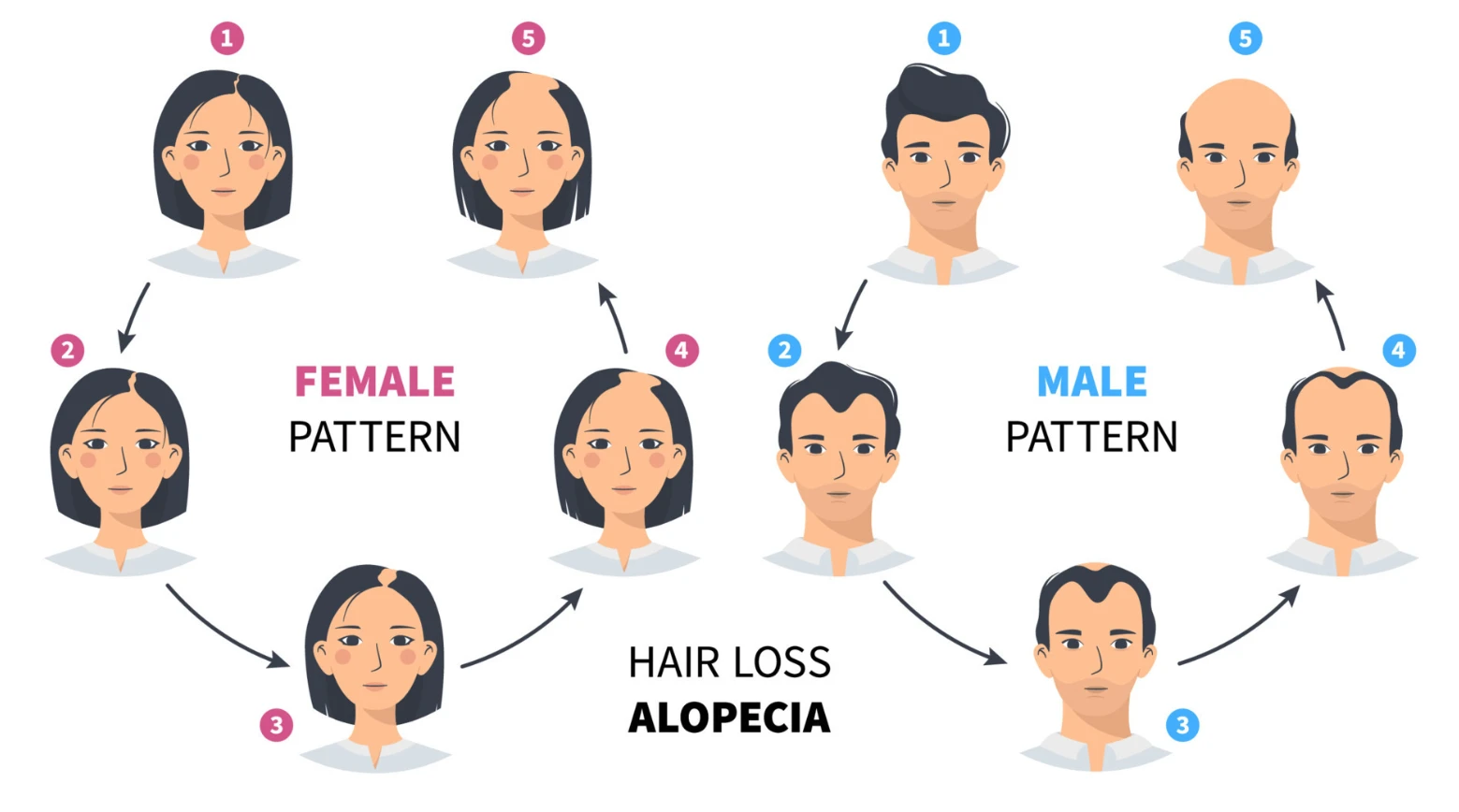 Ciri Kebotakan Pria dan Wanita Berbeda: Kenali Penyebab dan Cara Mengatasinya